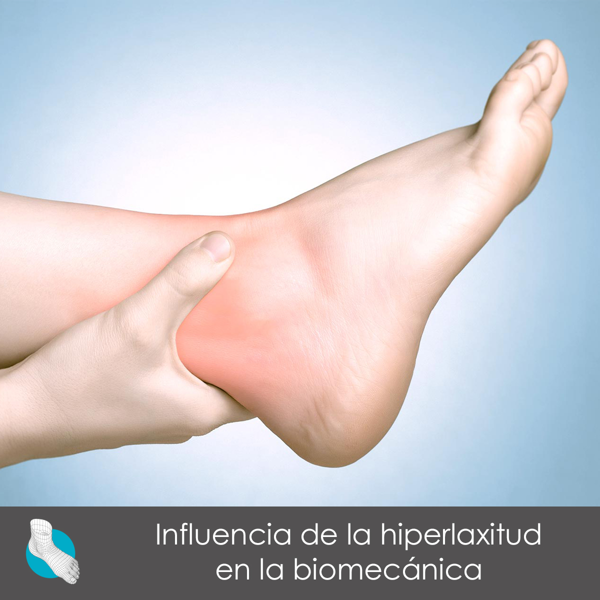 Influencia de la hiperlaxitud en la biomecánica